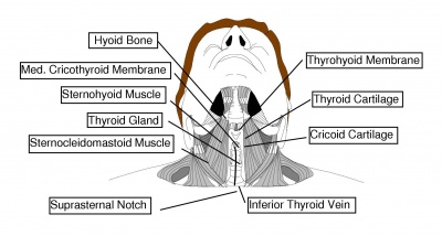 Cricothyrotomy Surgical - Protocopedia