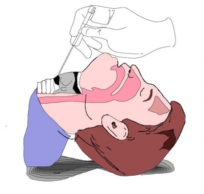 Cricothyrotomy Needle - Protocopedia