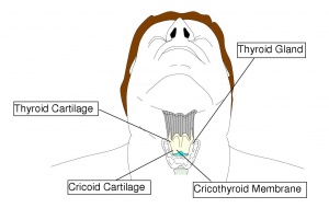 Cricothyrotomy Surgical - Protocopedia